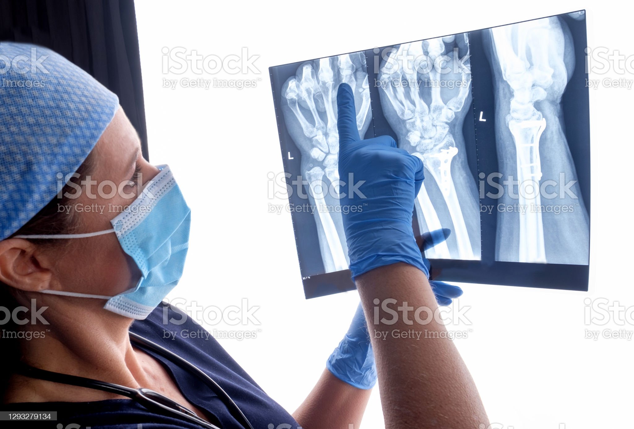 Røntgen - CPH Privathospital | Kontakt os i dag